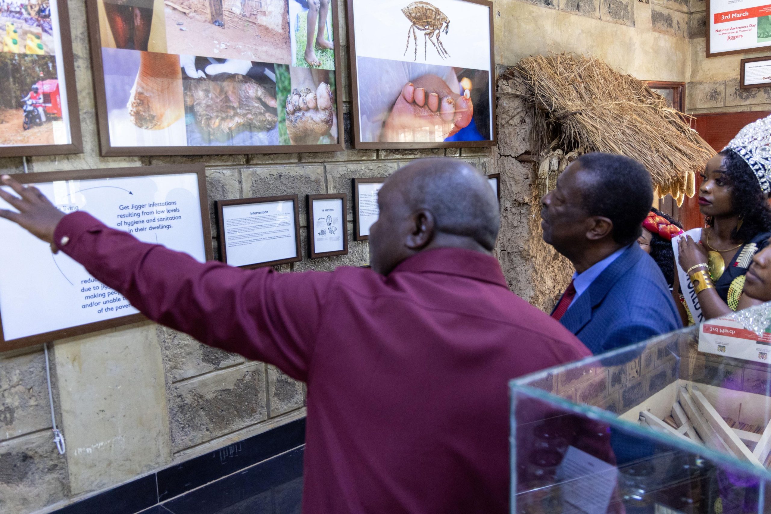 Mudavadi hails Kenya’s progress in war against jigger infestation | KBC ...